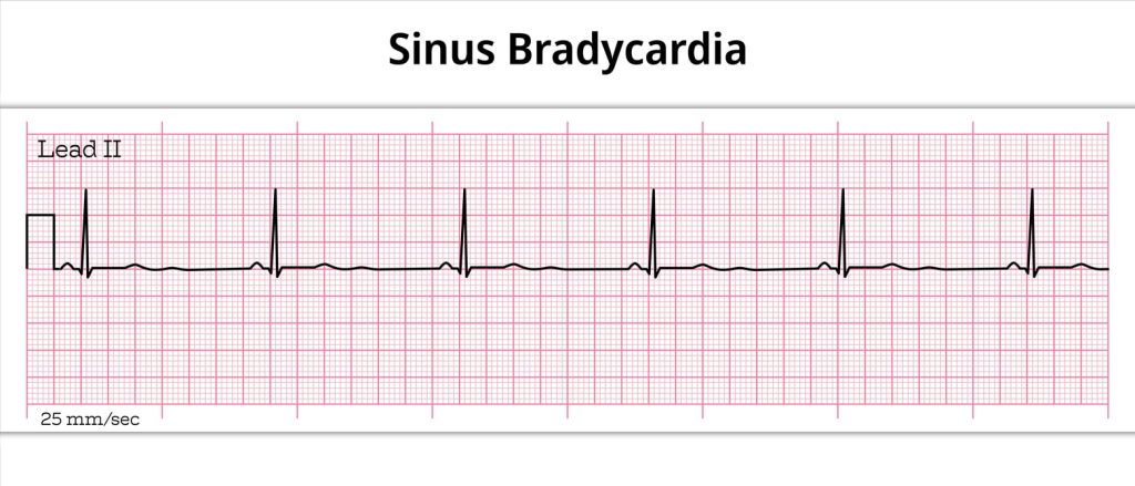 BLS Adult CPR Algorithm - Safety Training Seminars