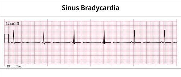 BLS Adult CPR Algorithm - Safety Training Seminars